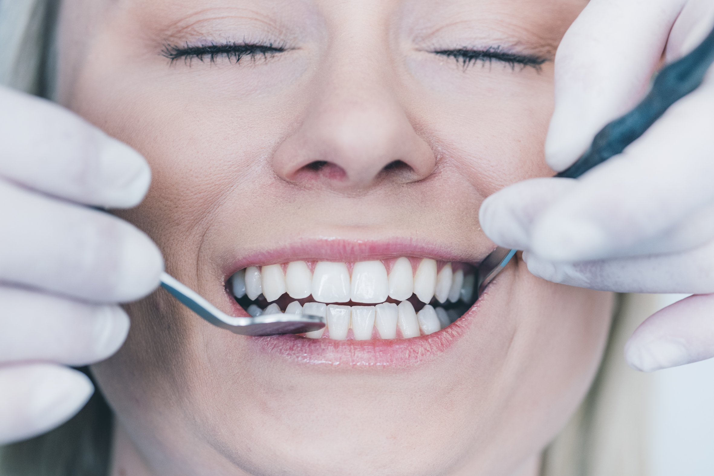 Keramikkronen und -brücken - zahneins GmbH